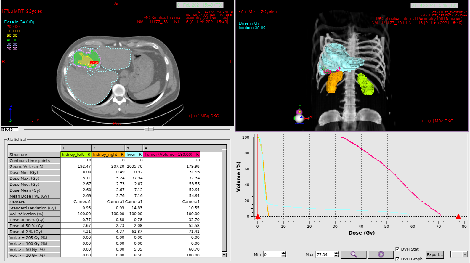 DOSIsoft - SNMMI 2025 Annual Meeting