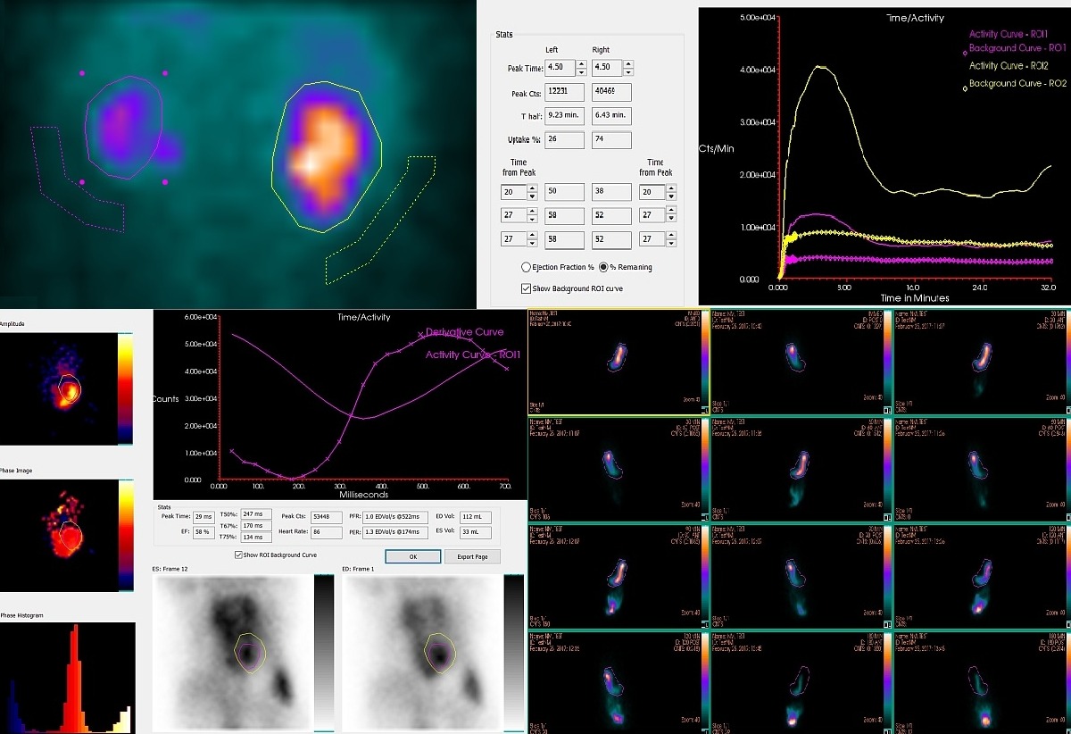 Convergent Imaging Solutions - SNMMI 2025 Annual Meeting